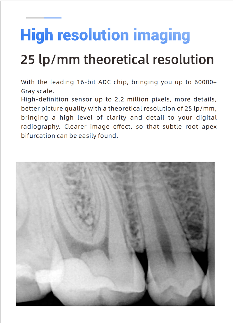 Woodpecker® i-Sensor Digital X-Ray Sensor